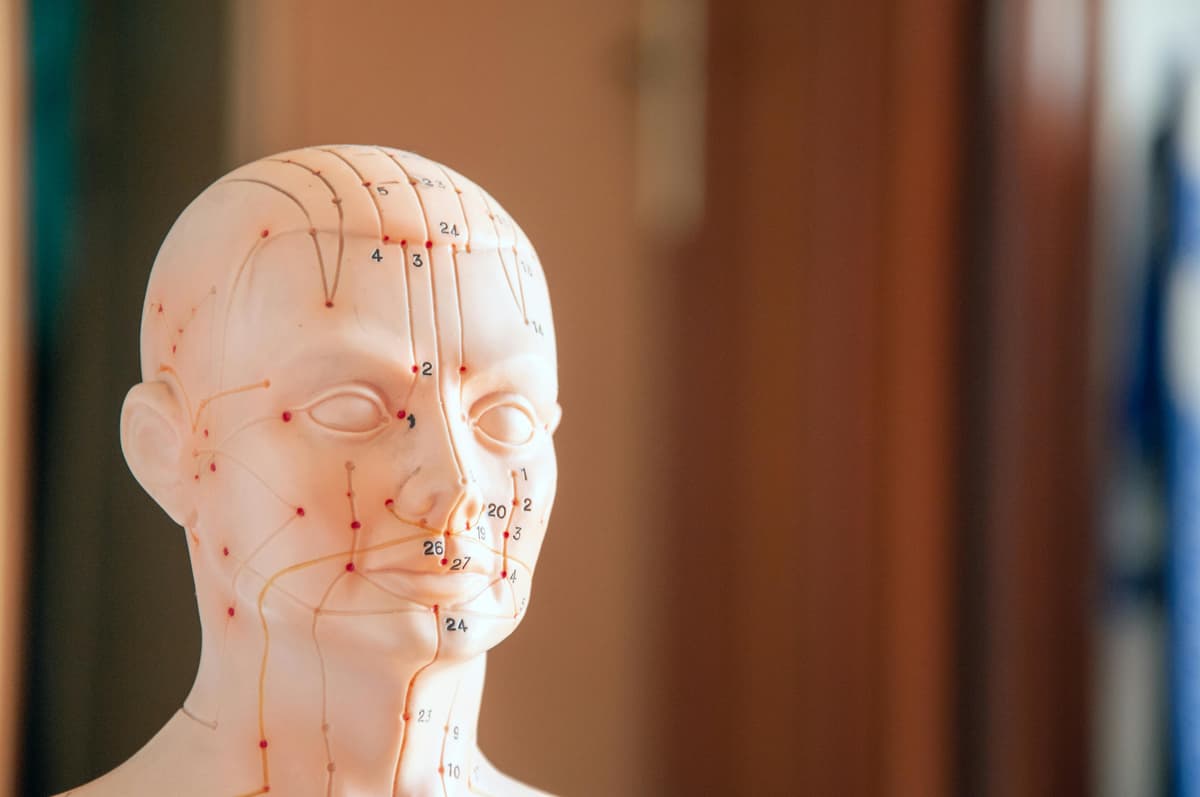 Is Acupuncture Expensive? A Comprehensive Cost Analysis | Harmony ...