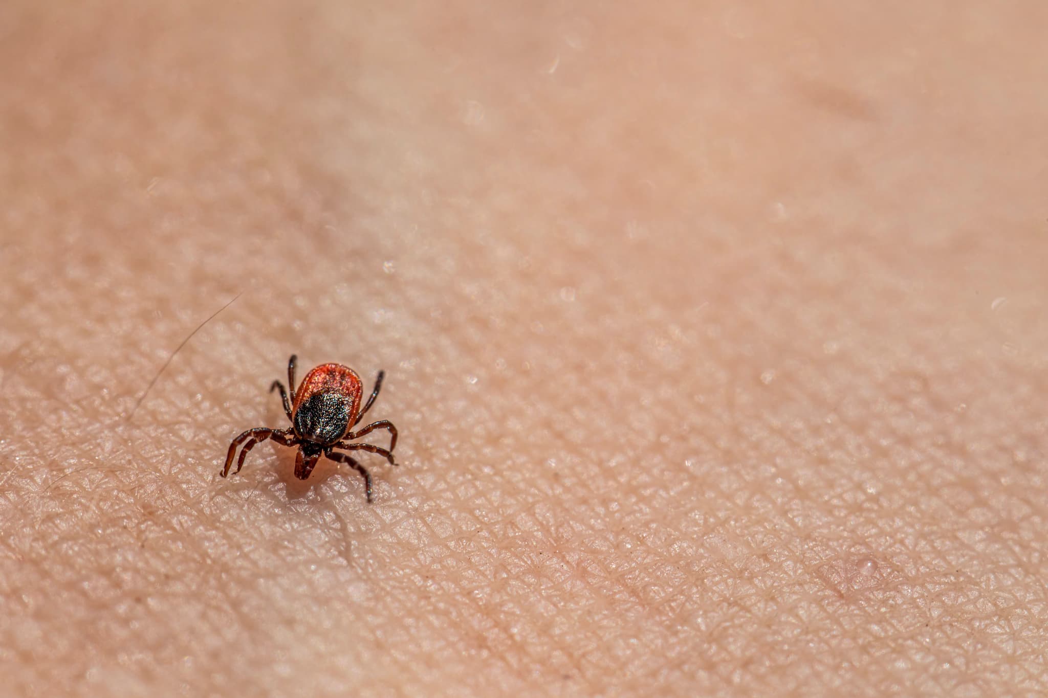 Can Fibromyalgia Cause Neuropathy? Exploring the Connection | Harmony ...