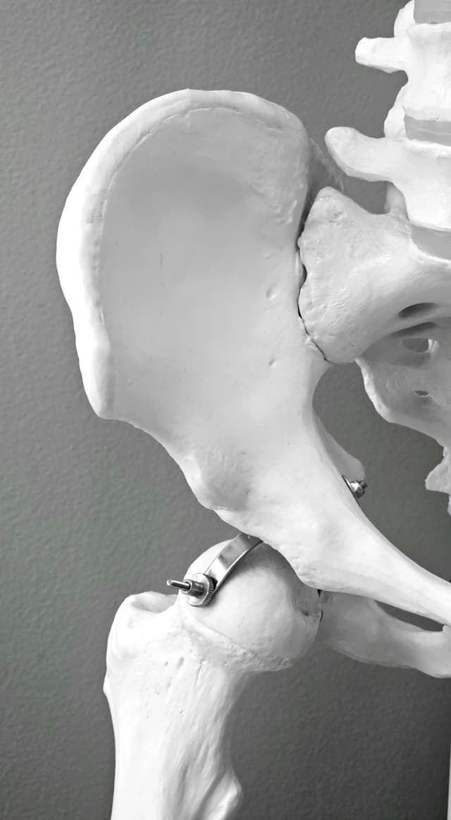 Back Pain After Hip Labrum Repair: Causes, Recovery, and Management ...