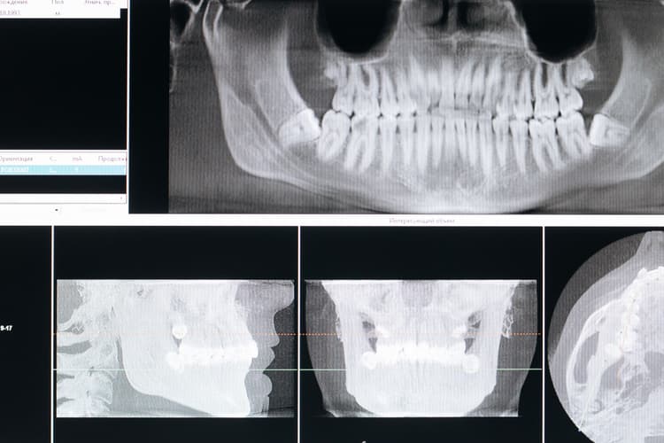 Understanding Oral Commissures: Anatomy, Function, and Clinical ...