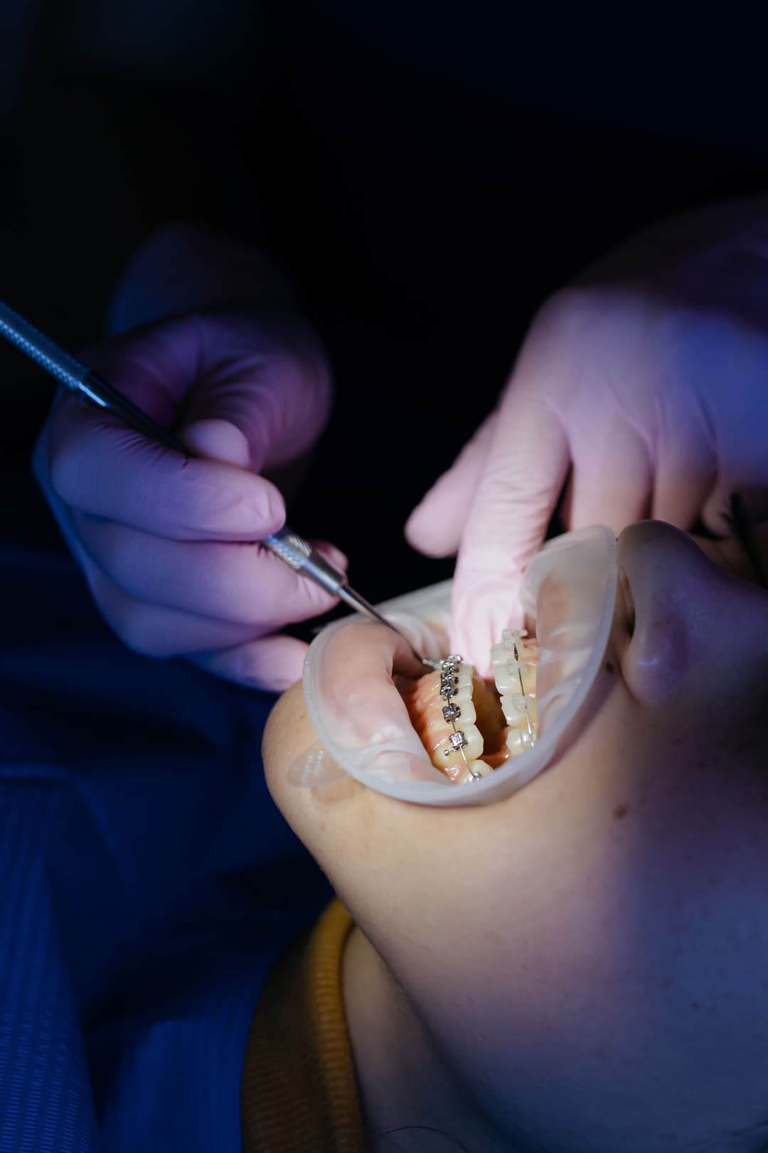 Understanding Muscle Spasms in the Jaw: Causes, Symptoms, and Treatment ...