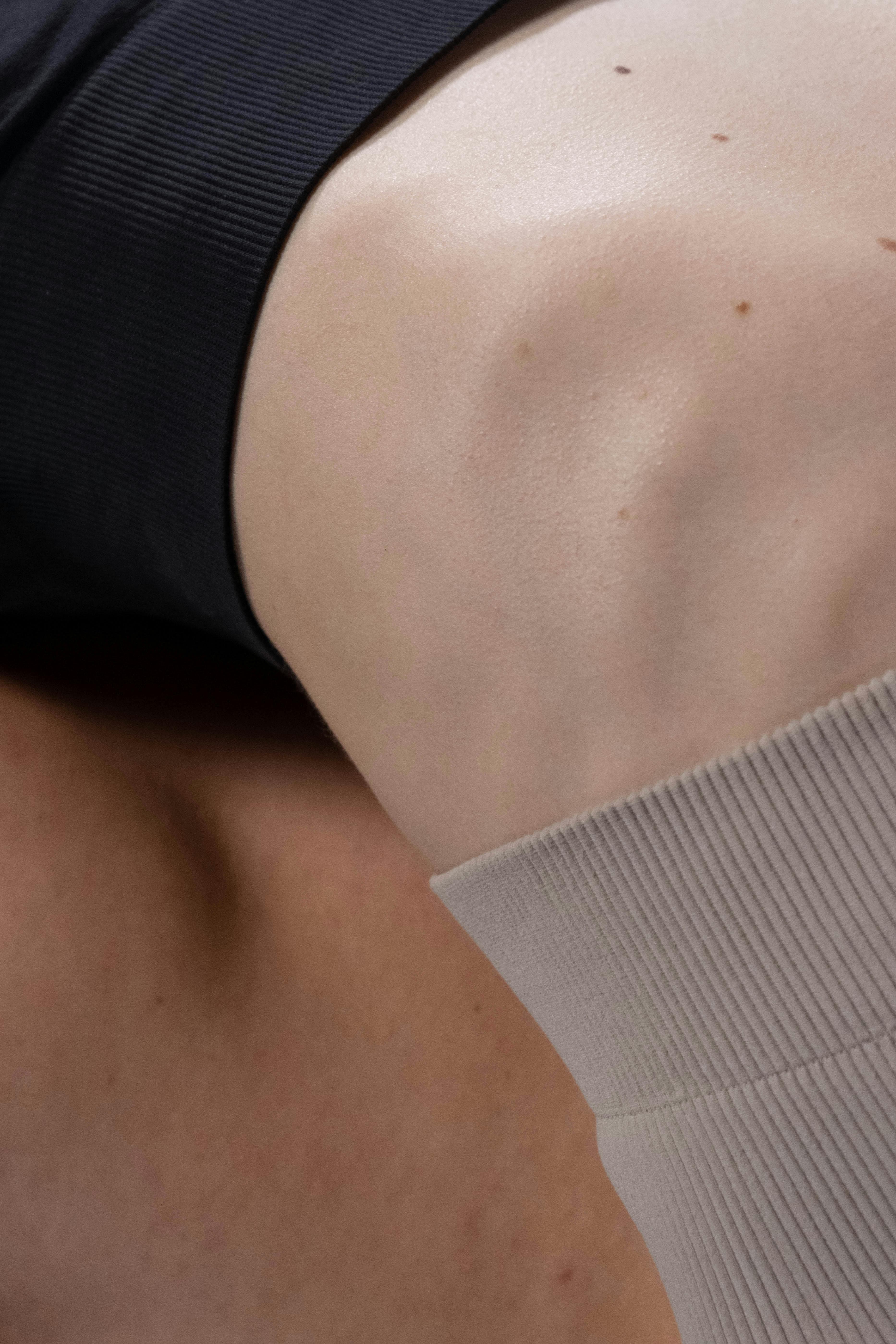 Adductor Longus Tendon Tear: Symptoms, Diagnosis, and Treatment ...