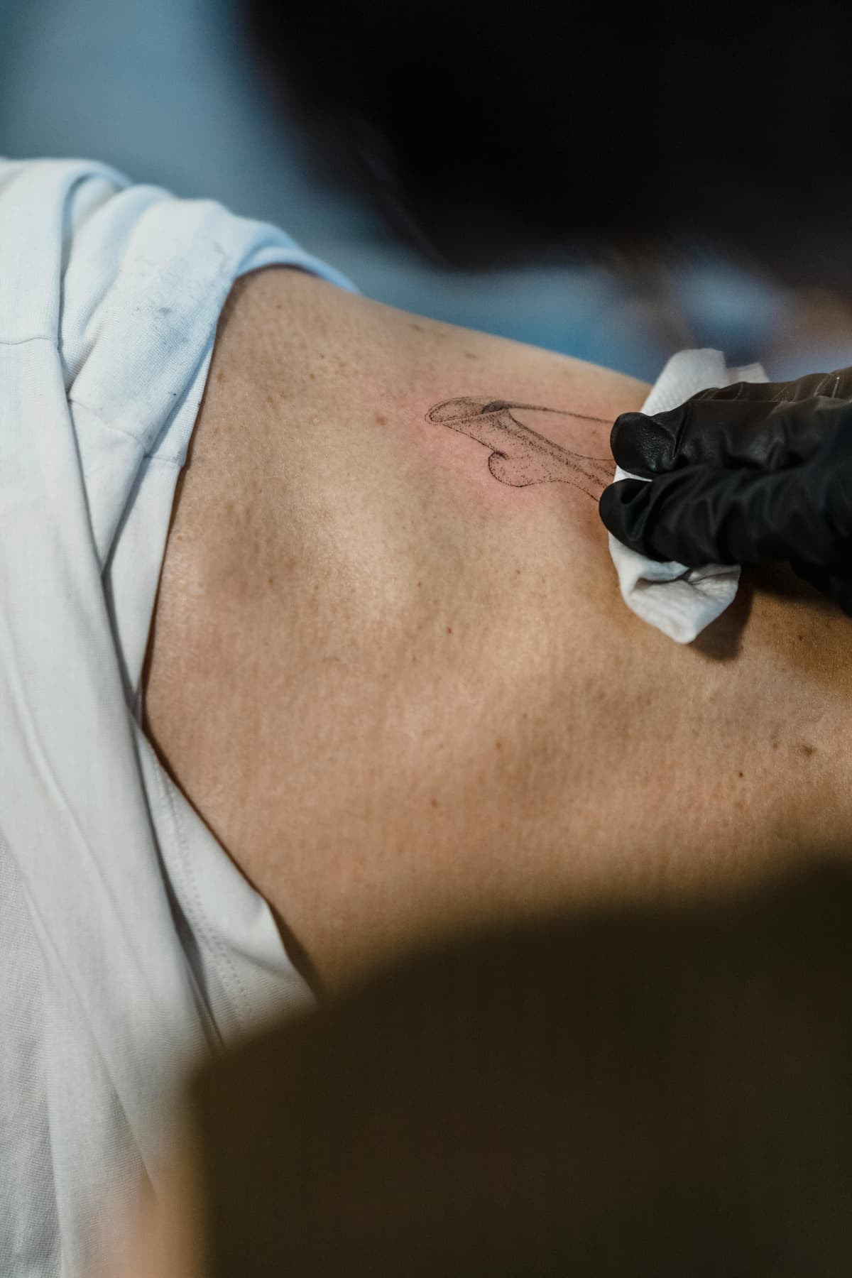 How to Get Rid of a Neck Lump: A Comprehensive Guide | Harmony Wellness ...