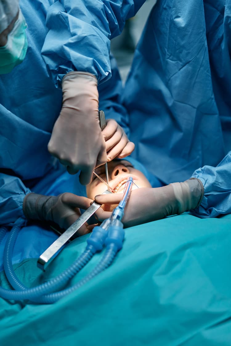 Cataract Surgery Stitches: Evolution, Techniques, and Modern Approaches ...