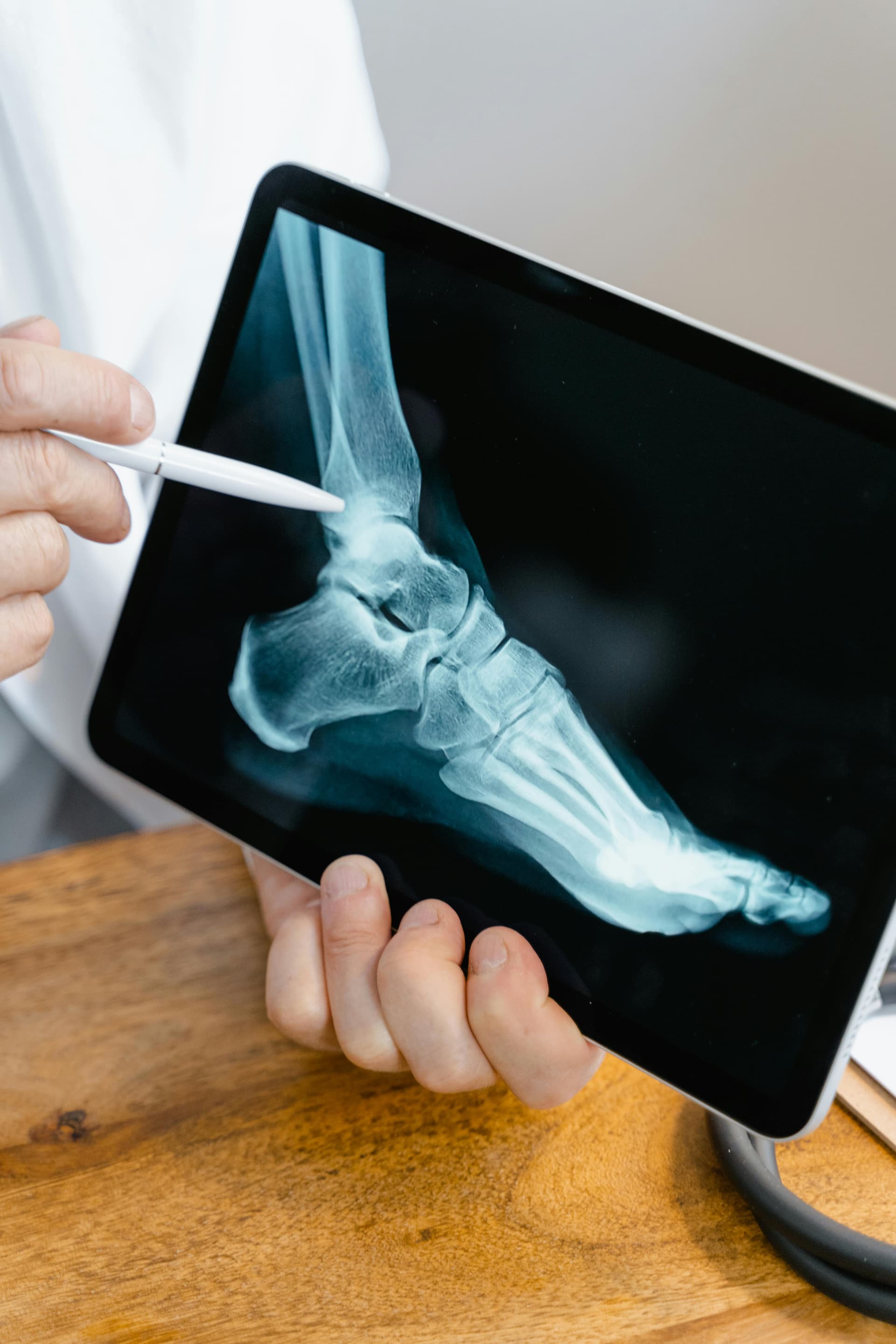 Drop Foot After Knee Replacement: Causes, Treatment, and Recovery ...