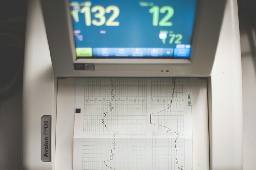 Understanding Normal Sinus Rhythm with PAC: What You Need to Know ...